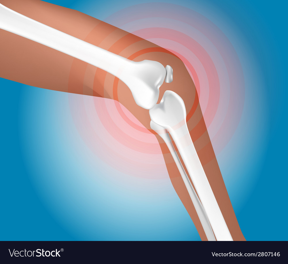 Bone knee Royalty Free Vector Image - VectorStock