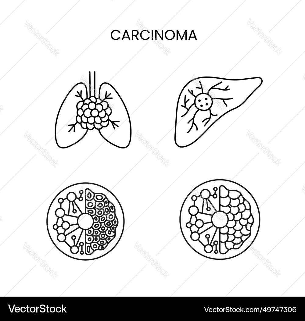 Cancer carcinoma line icon malignant Royalty Free Vector