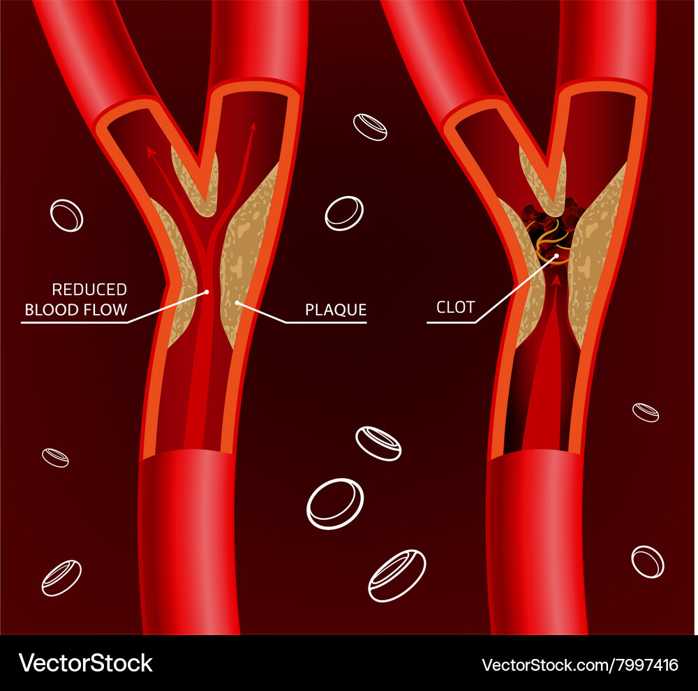 Blood Flow & Vascular Health Royalty Free Vector Image