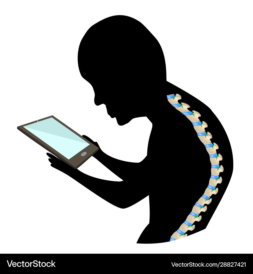 Text neck syndrome spinal curvature kyphosis Vector Image
