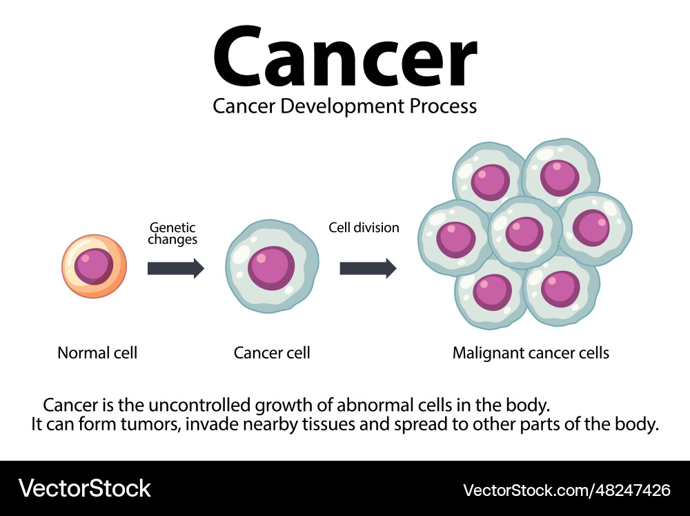 Processing of cancer cells an infographic Vector Image