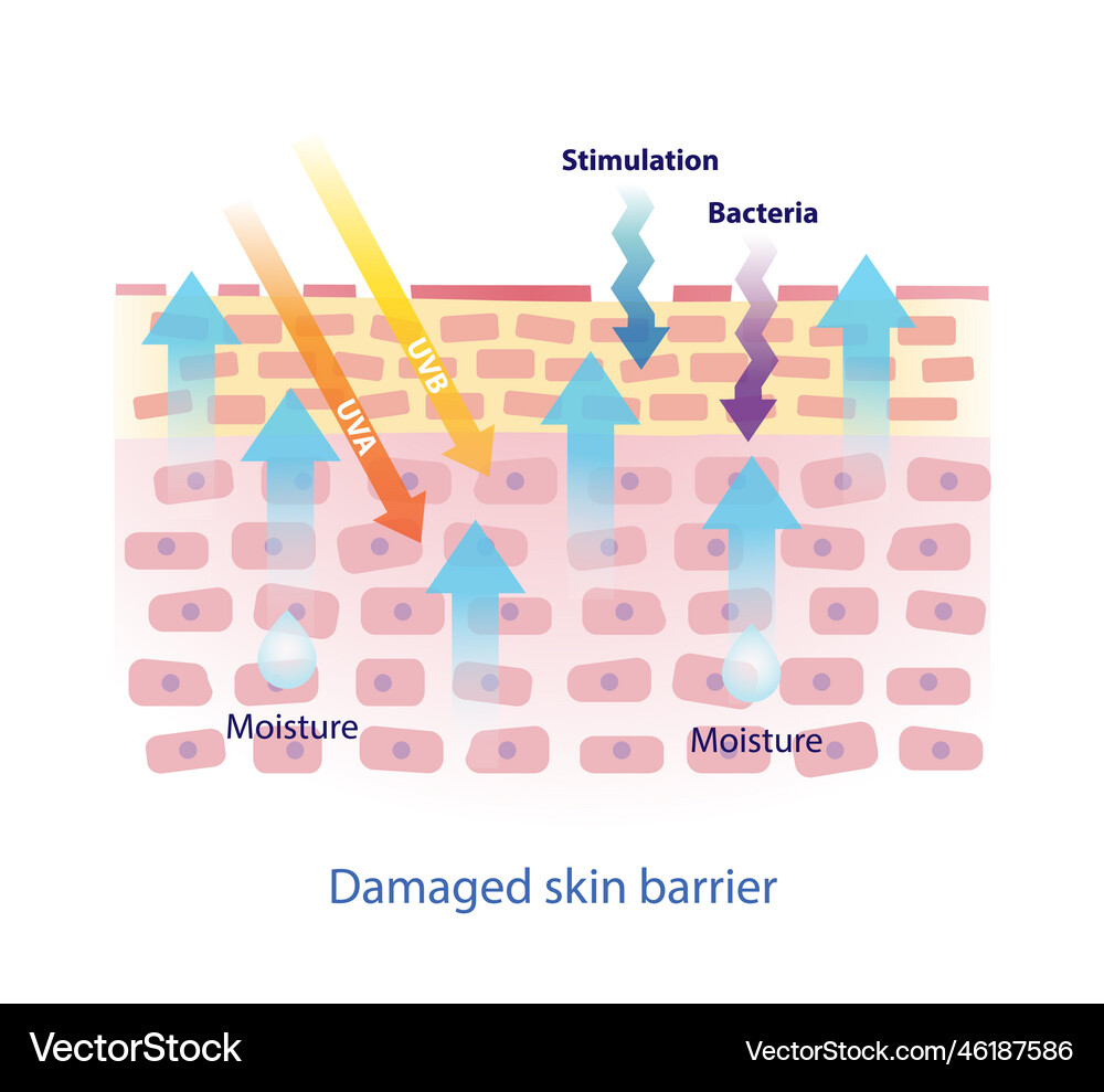 Structure of damaged skin barrier Royalty Free Vector Image