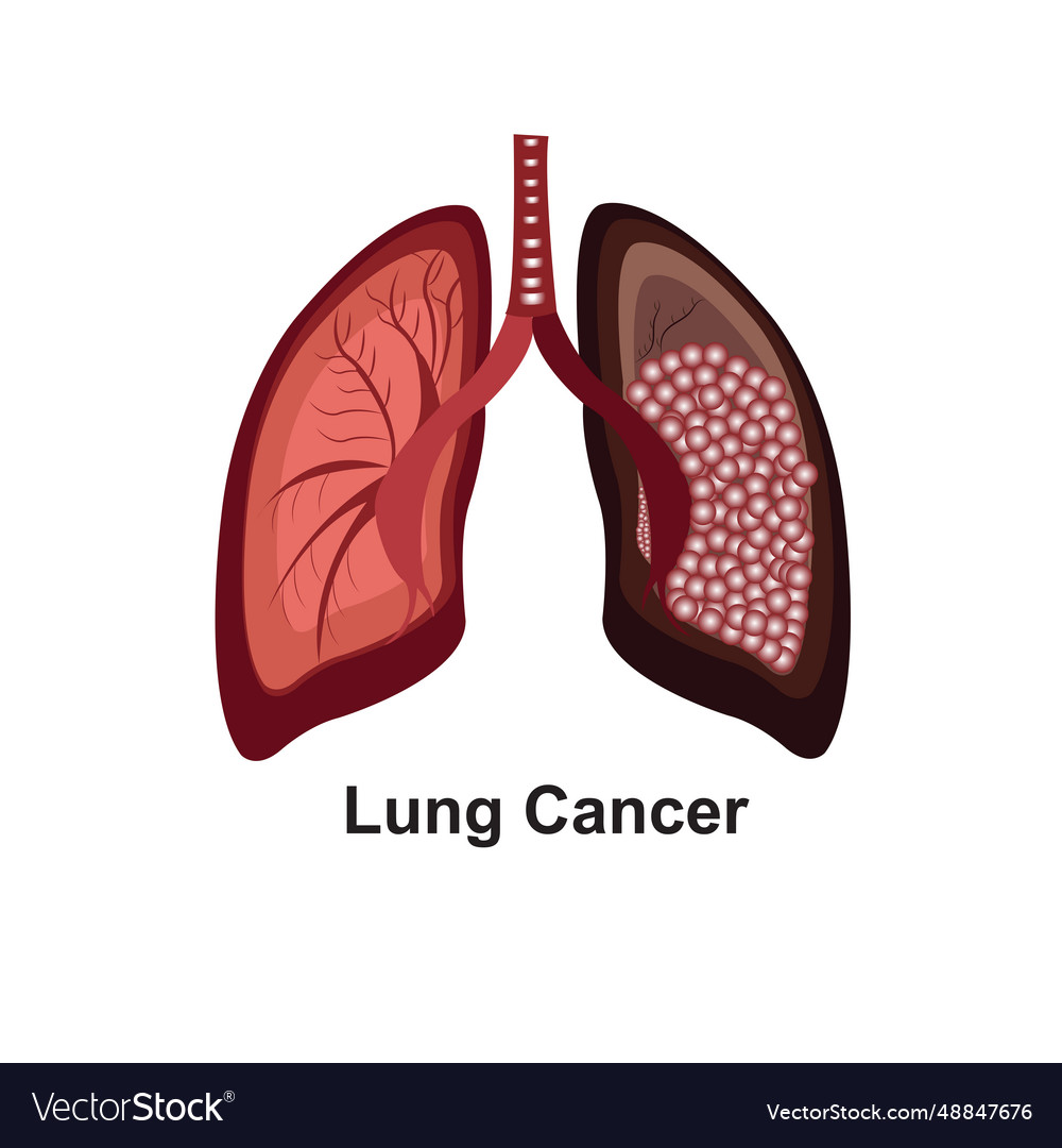 Lungs Royalty Free Vector Image - VectorStock