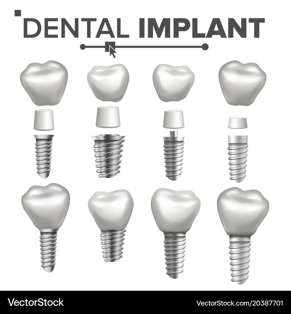 Dental implant set clinic Royalty Free Vector Image