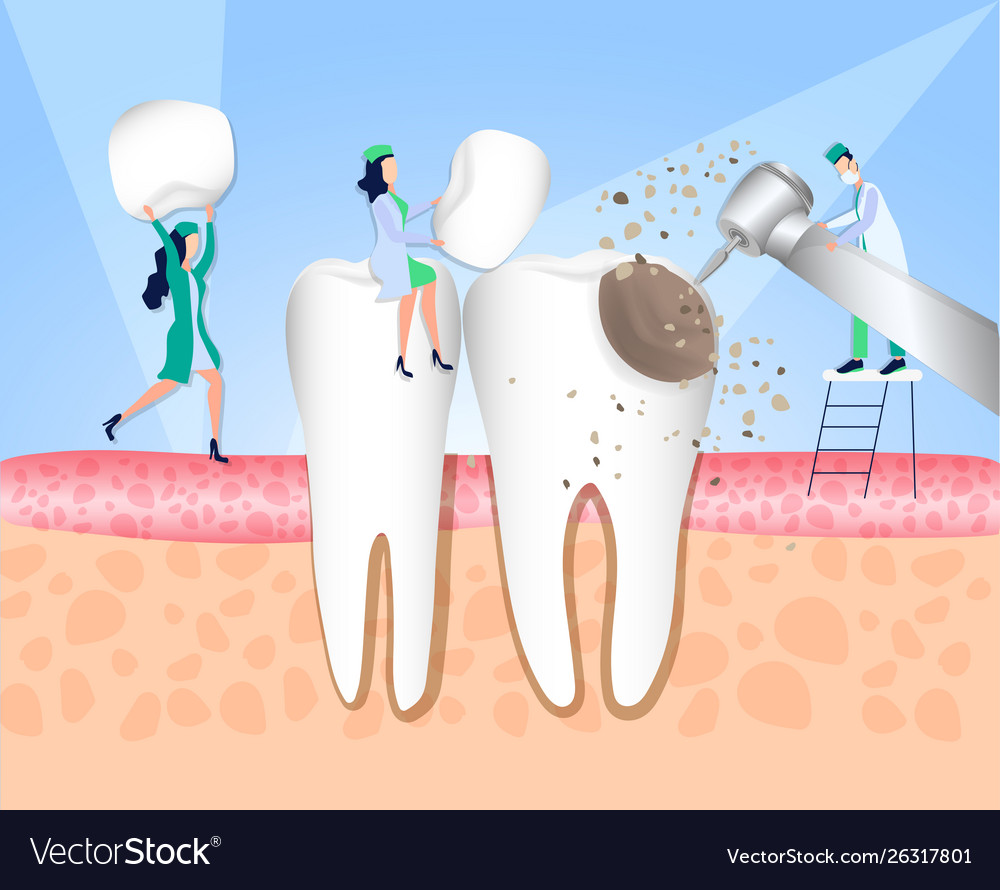 Dentistry teeth treatment whitening Royalty Free Vector
