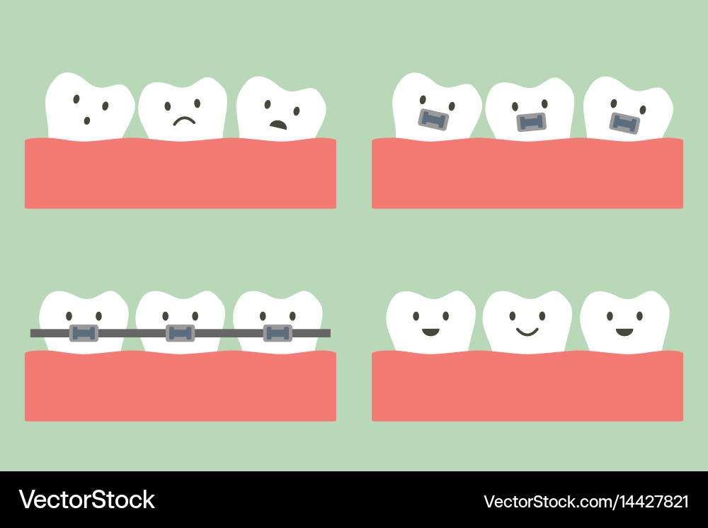 Dental orthodontics treatment with teeth braces Vector Image