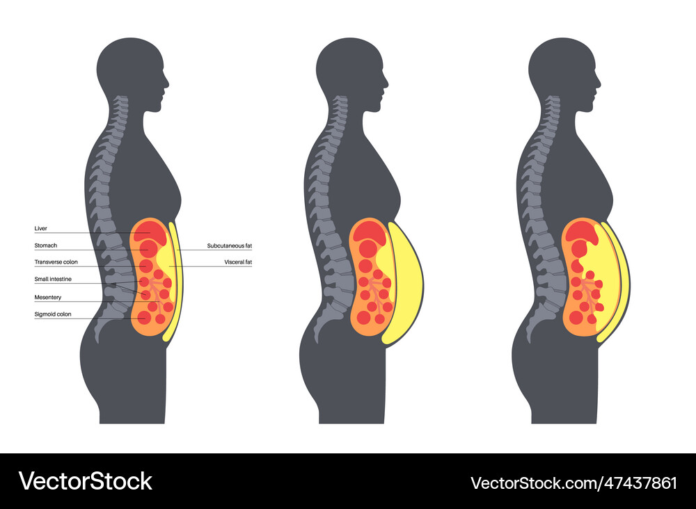Visceral Fat Anatomy Diagram Royalty Free Vector Image