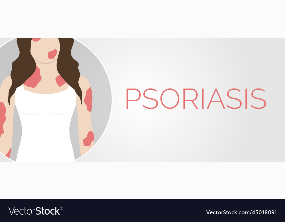 Psoriasis Skin Illness Background Design Vector Image