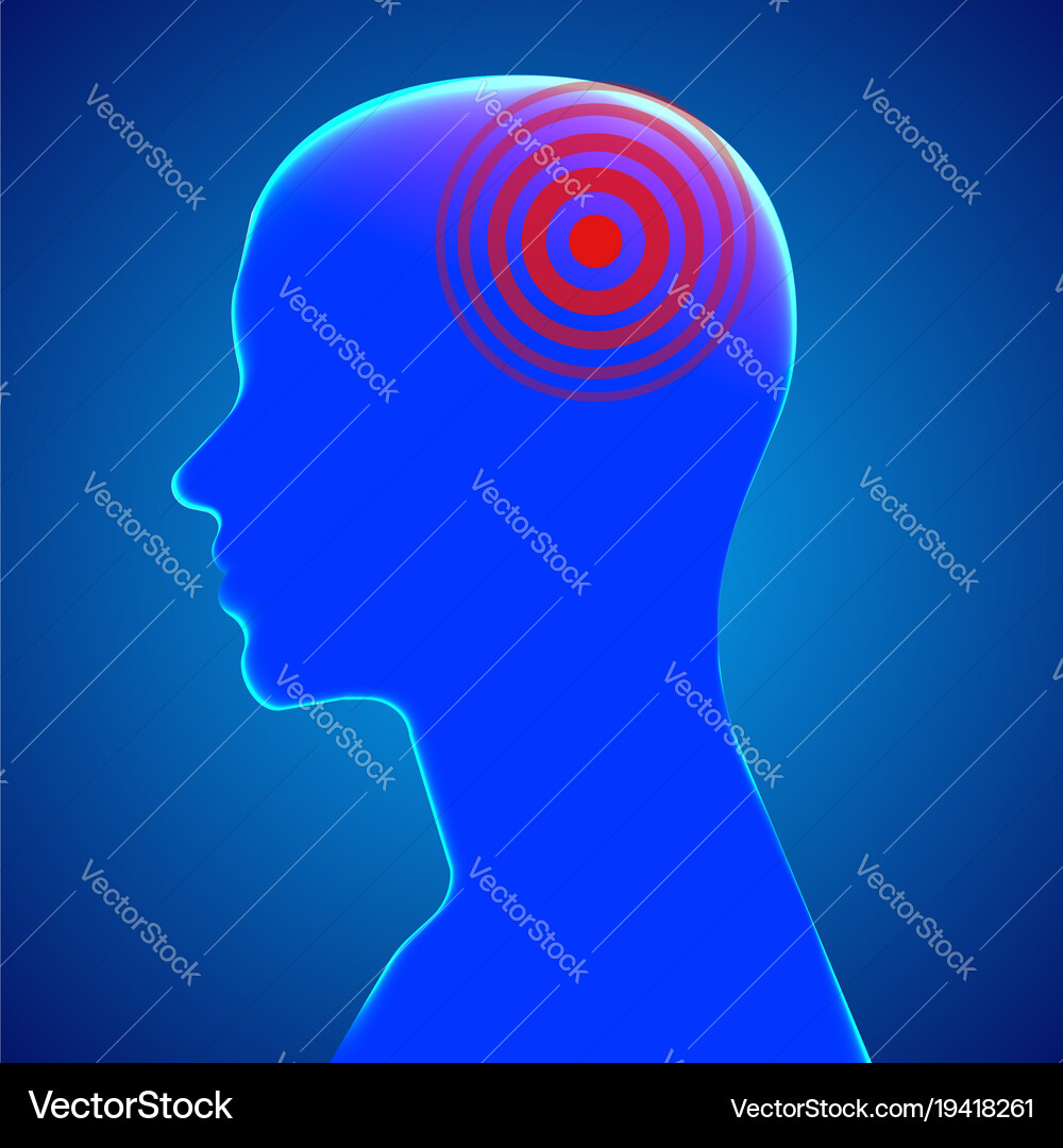 Headache male head with pain dot Royalty Free Vector Image