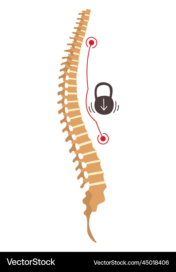 Spinal deformity symbol of spine curvatures Vector Image