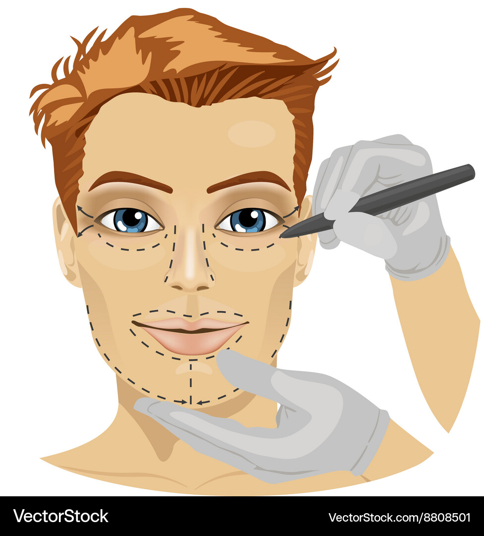 Guide lines for surgical incisions on patient face