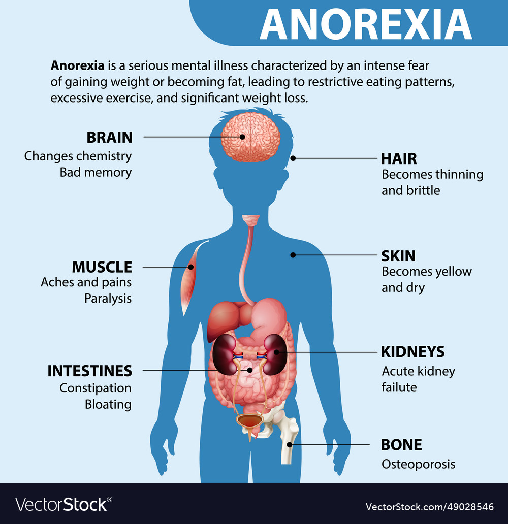Effects of anorexia on male anatomy Royalty Free Vector