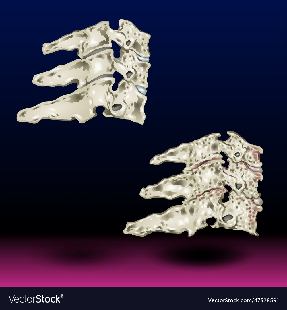 Neck bone Royalty Free Vector Image - VectorStock