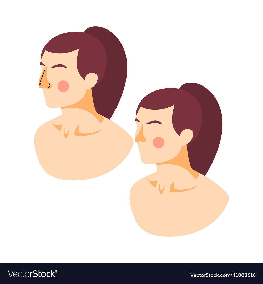 Plastic surgery icon Royalty Free Vector Image