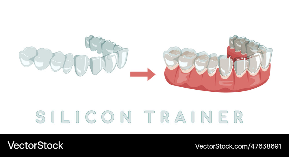 Invisible braces aligner retainer medical Vector Image