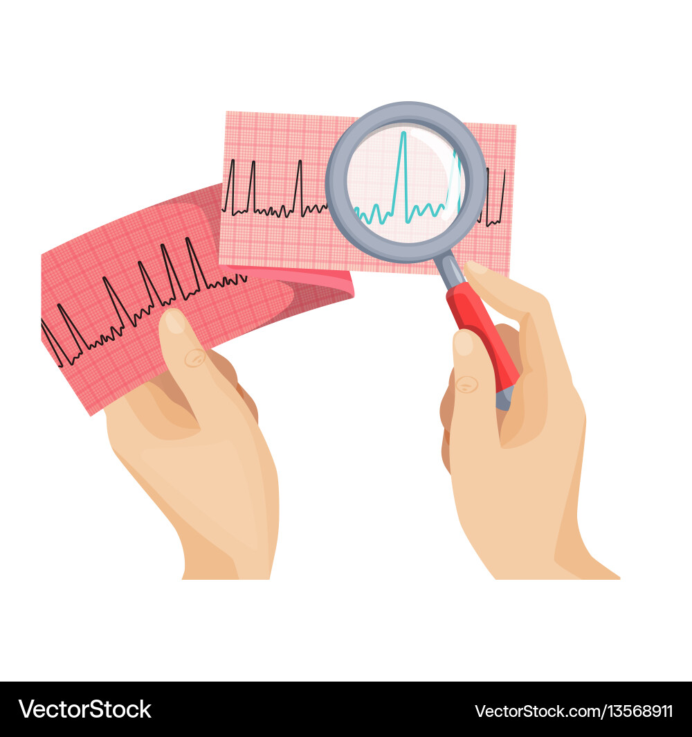 Look at atrial fibrillation through magnifying Vector Image