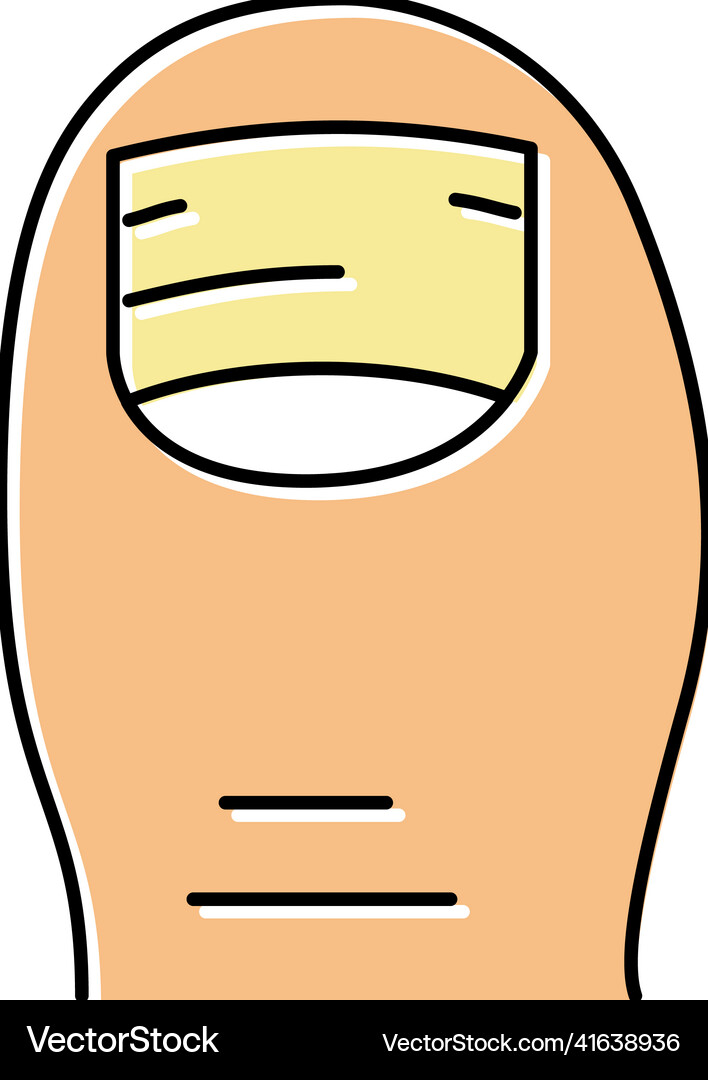 Psoriasis nail disease color icon Royalty Free Vector Image