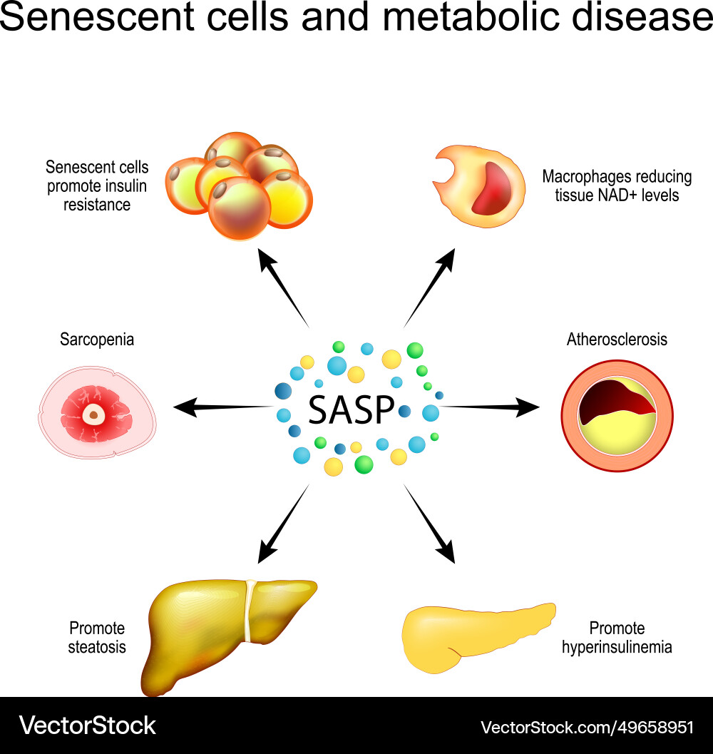 Sasp senescent cells and metabolic disease Vector Image
