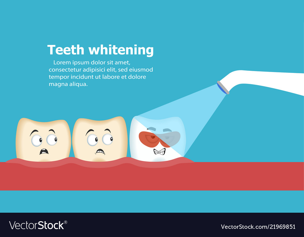 Professional teeth whitening Royalty Free Vector Image