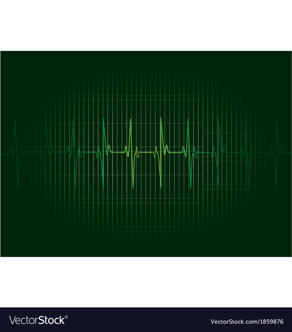 EKG Royalty Free Vector Image - VectorStock