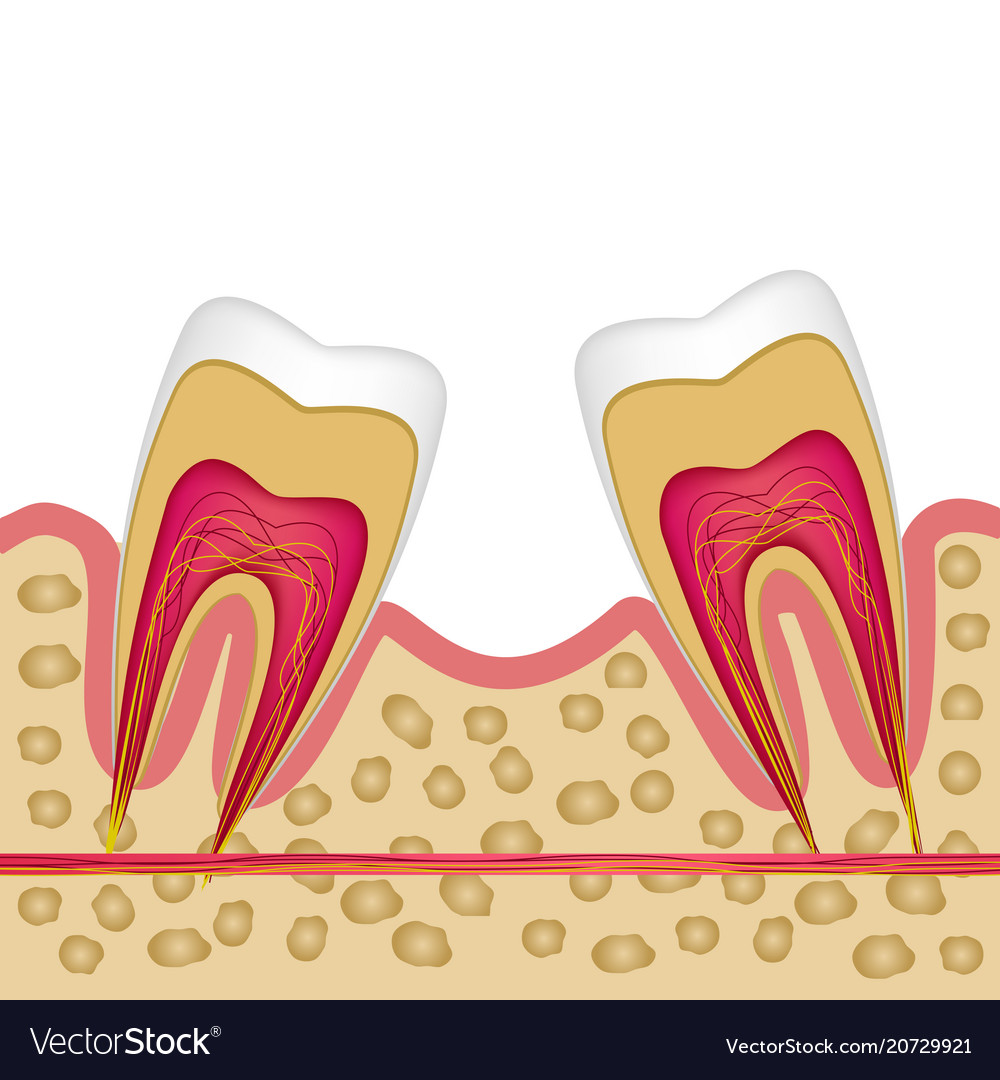 Defect of the missing tooth and need Royalty Free Vector