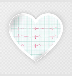 Ecg Graph Vector Images (over 7,700)
