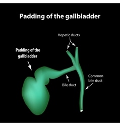 Double gall bladder pathology gallbladder Vector Image