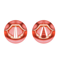 Vocal Vector Images (over 17,000)