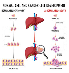 Diagram showing cancer development process Vector Image