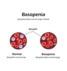 Basophils below normal range in blood Royalty Free Vector