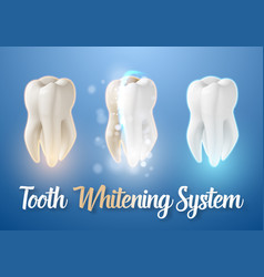 Stomatology concept dentist cleaning teeth Vector Image